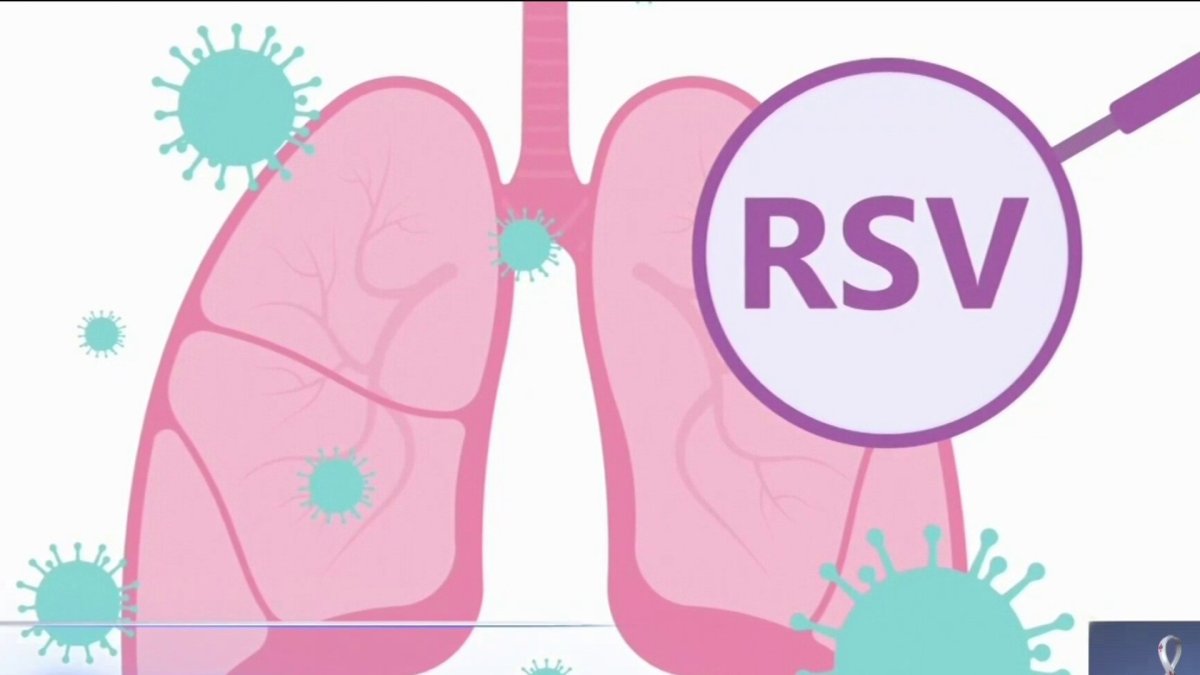 Virus Sincitial Respiratorio: síntomas y formas de prevención ...